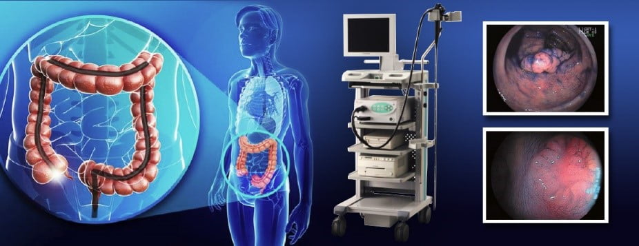 Orientações após Colonoscopia – Gastroclinic